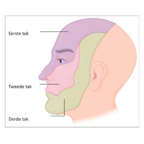 Aangezichtspijn | Trigeminus Neuralgie Zorg in Laarbeek